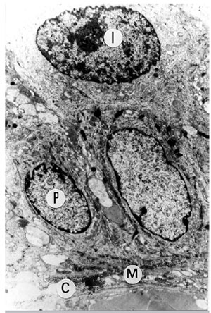 Study and evaluation of neovagina epithelium
