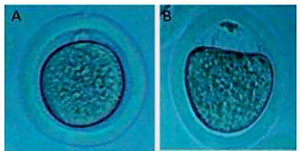 Oocyte quality and aging